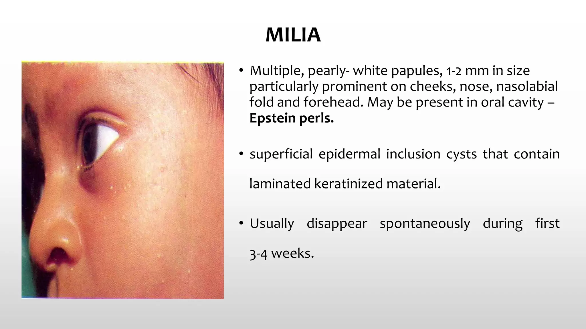Pediatric Skin Diseases by Dr. Ramkesh Meena | PPTX