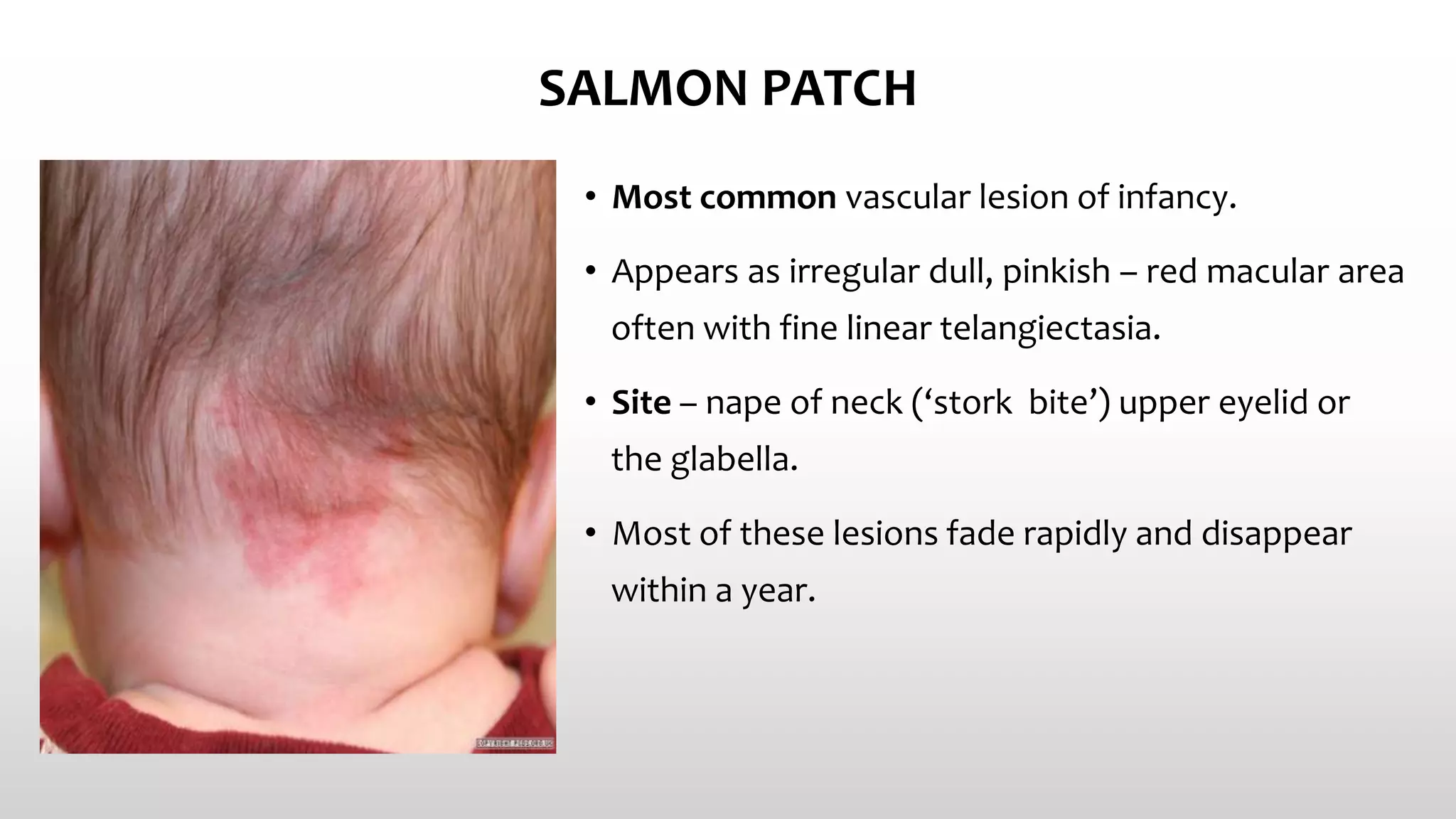 Pediatric Skin Diseases by Dr. Ramkesh Meena | PPTX