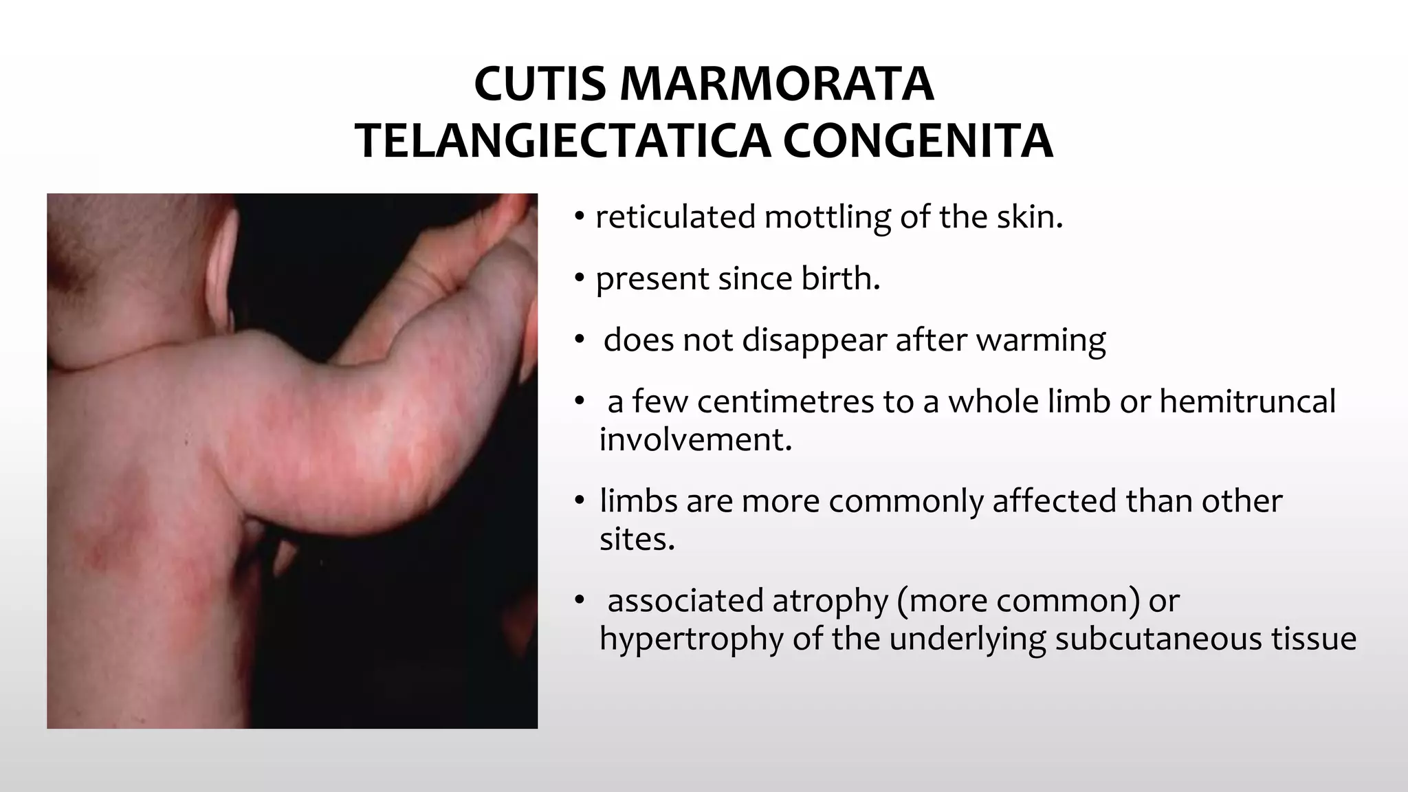 Pediatric Skin Diseases by Dr. Ramkesh Meena | PPTX