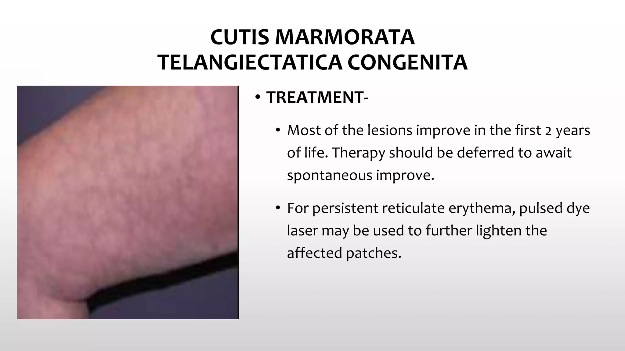 Pediatric Skin Diseases by Dr. Ramkesh Meena | PPTX