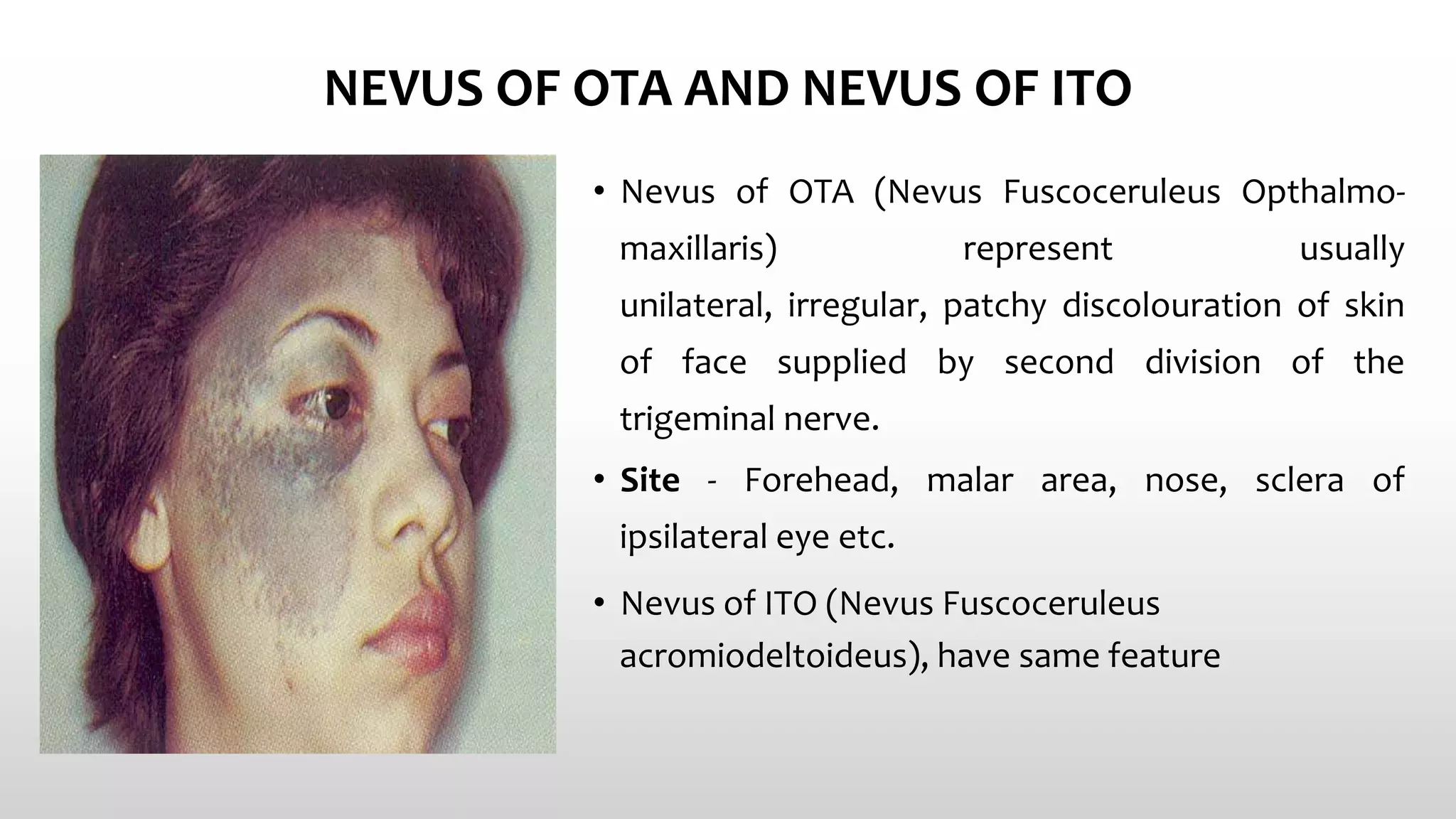 Pediatric Skin Diseases by Dr. Ramkesh Meena | PPTX
