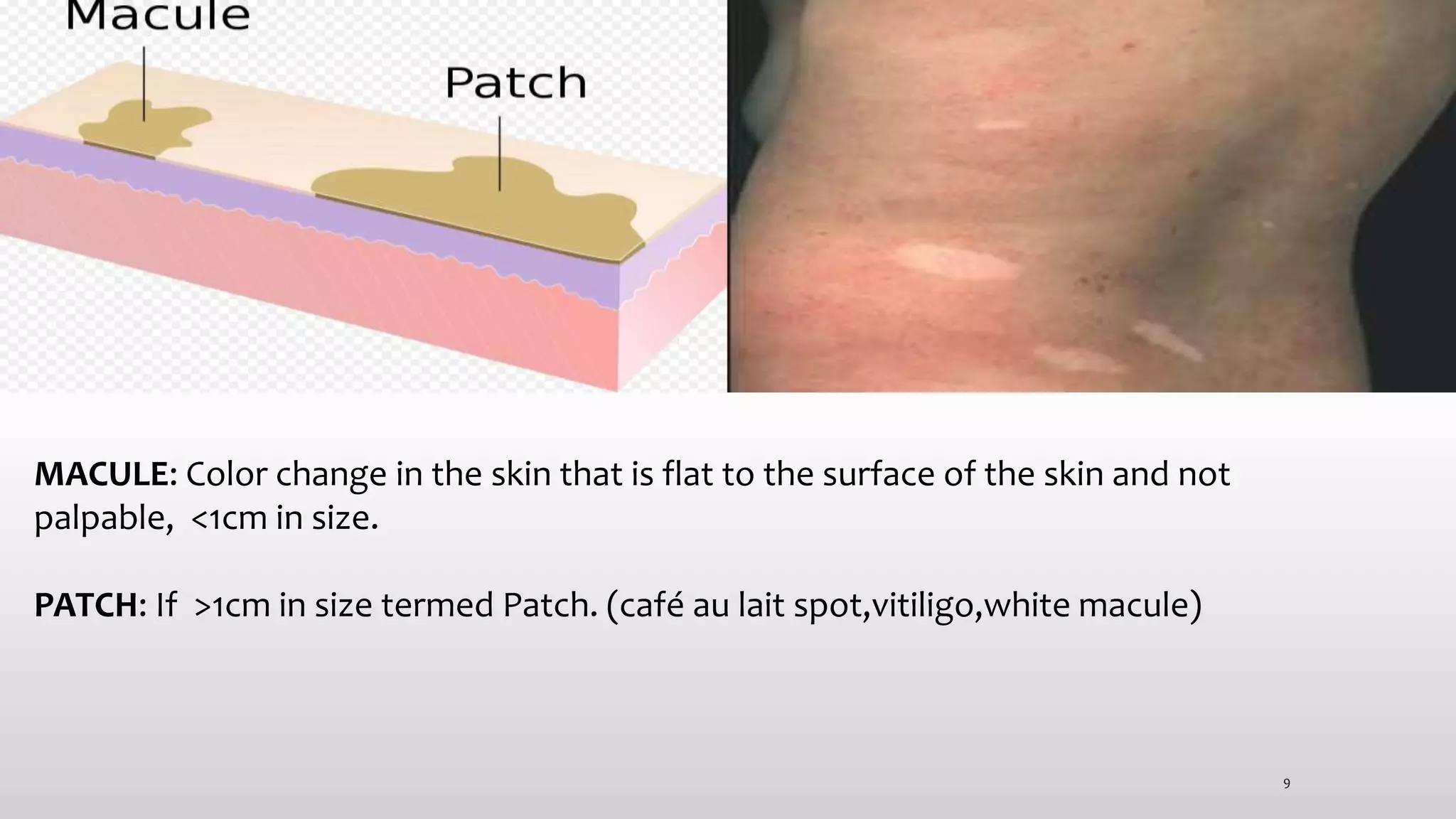 Pediatric Skin Diseases by Dr. Ramkesh Meena | PPT