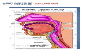 Appropriate airway equipment and techniques. | PPTX