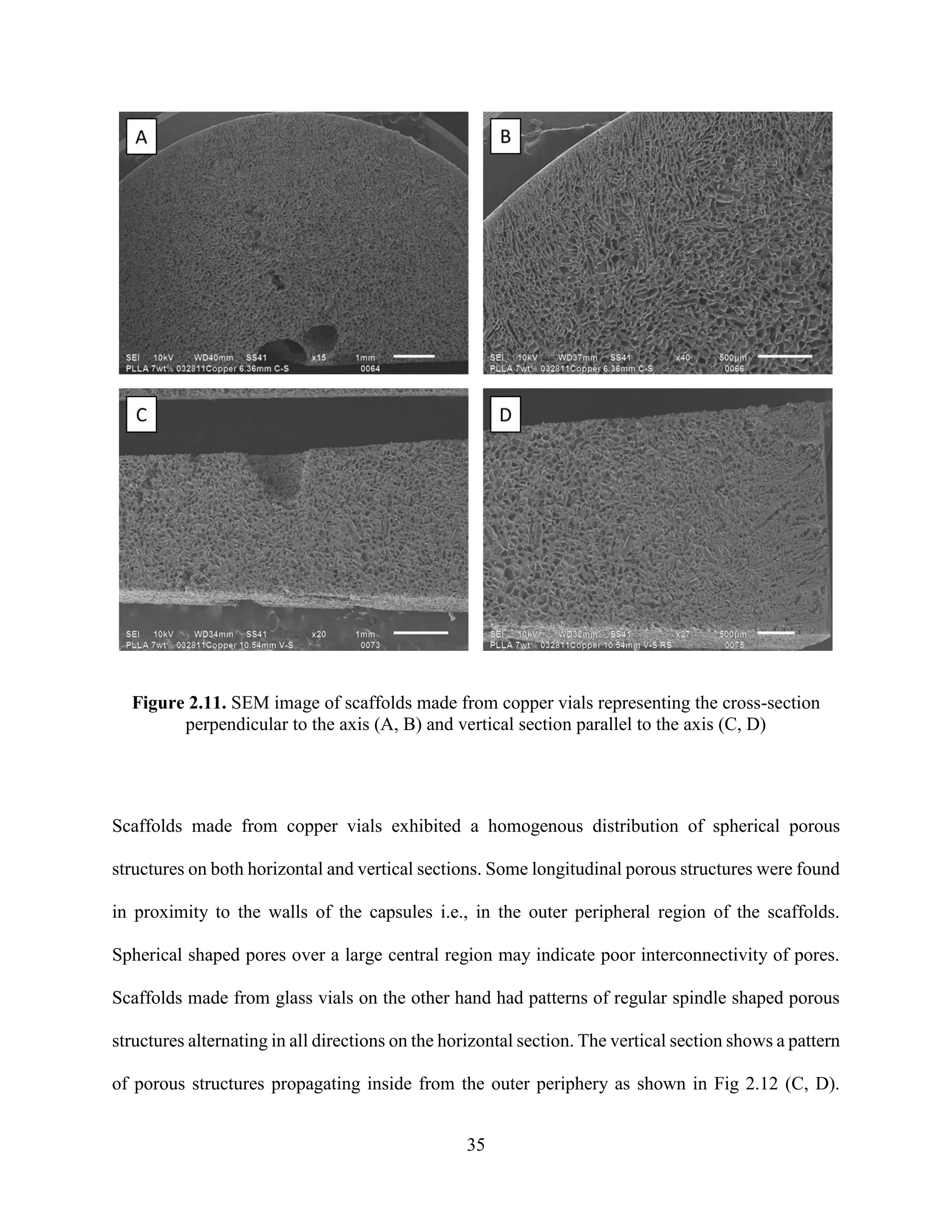 OSTEOGENIC POTENTIAL OF POLY (L-LACTIC ACID) SCAFFOLDS PREPARED BY THERMALLY CONTROLLED METHODS ...