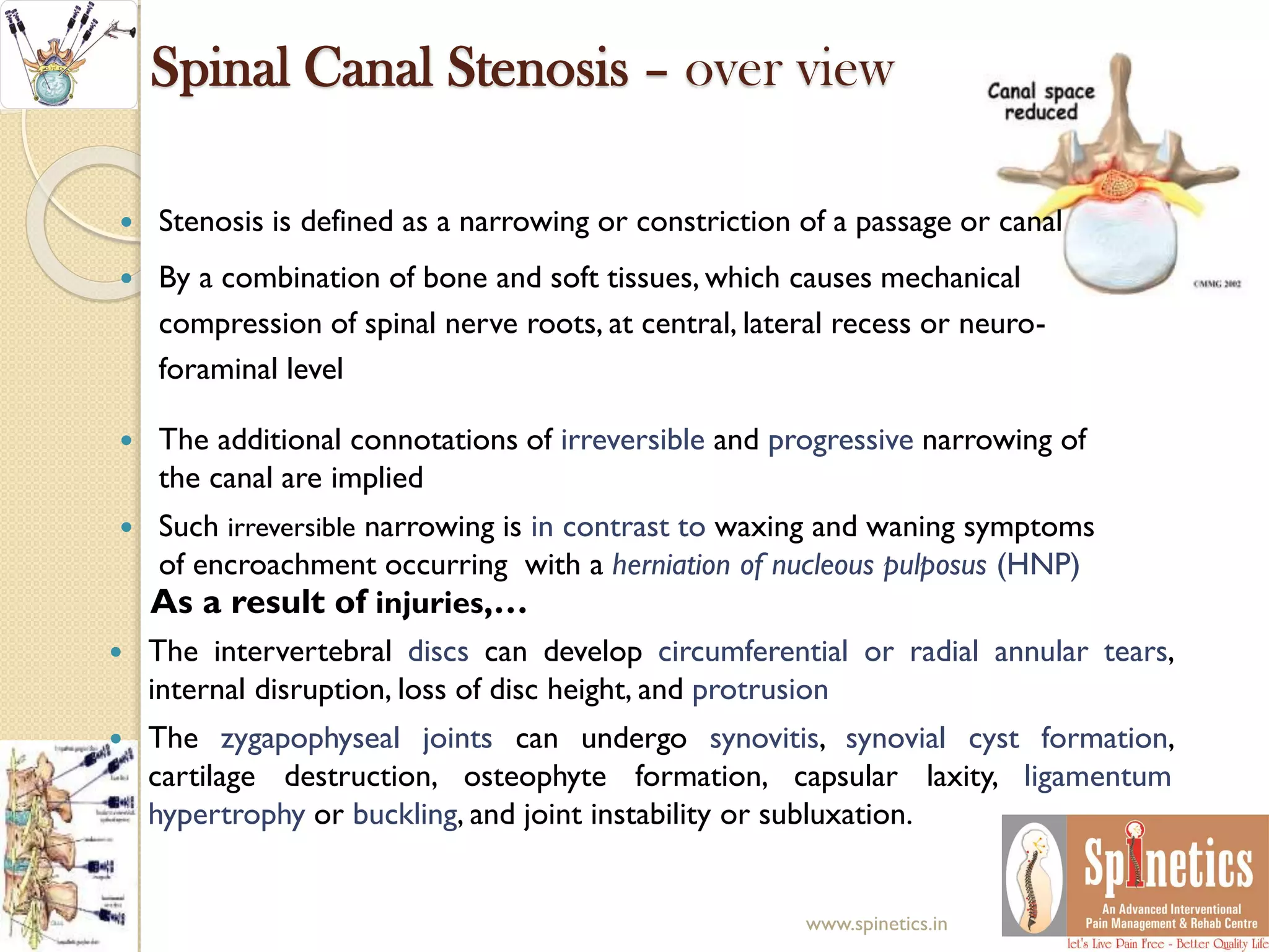 Ozone Nucleolysis vs Idet for Lumbar Disk | PPTX