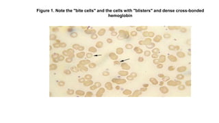 A Practical Approach to Anemia | PPT