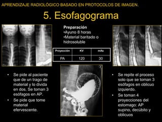 Aprendizaje radiológico basado en protocolos de imagen | PDF