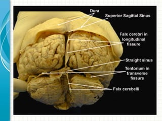 Anatomia da fossa craniana posterior FCP | PPTX
