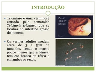 Trichuris trichiura | PPT