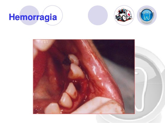 Apresentacao urgencias e_emergencias_odontologia