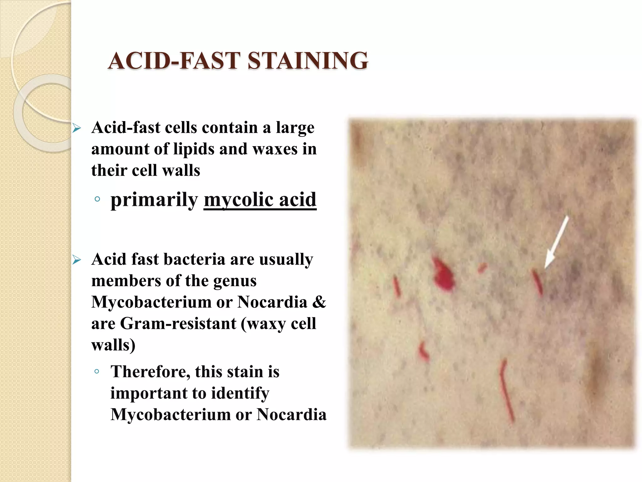 A presentaion on bacterial staining | PPT