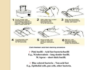 A presentaion on bacterial staining | PPT