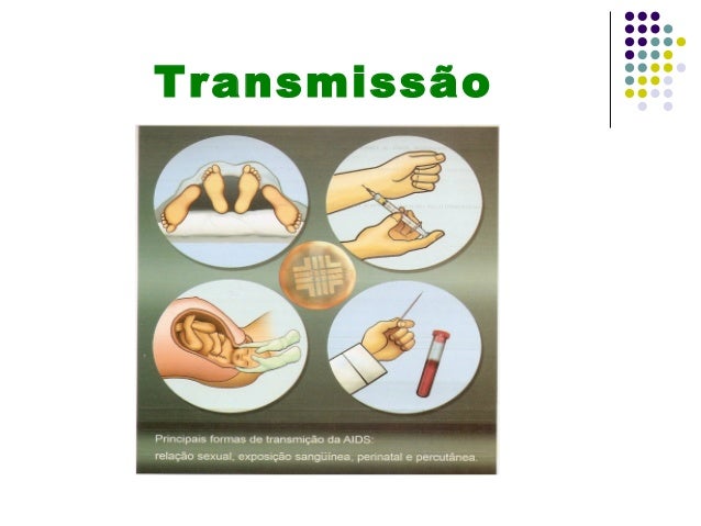 Apresentação AIDS - DST