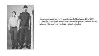 sindrome de jacobs | PPTX