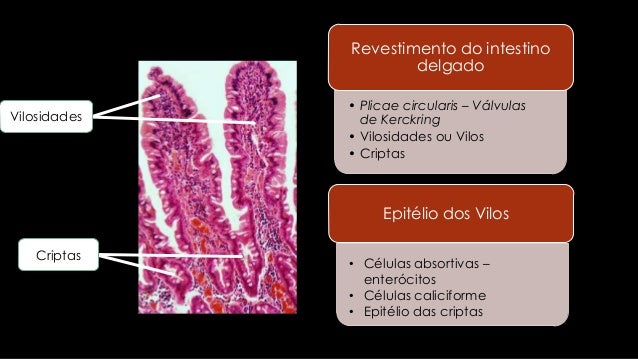 Histologia Intestino Delgado