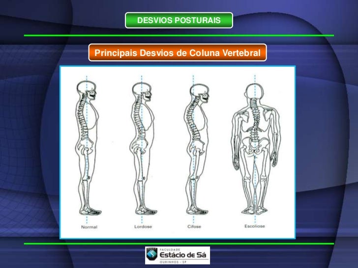Apresentação desvios posturais