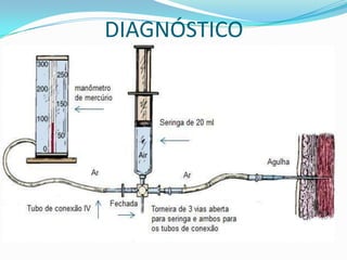 Síndrome do esmagamento | PPTX