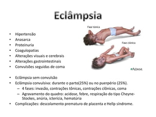 Eclâmpsia | PPT
