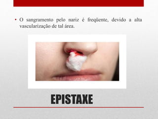 primeiros socorros - hemorragia | PPTX
