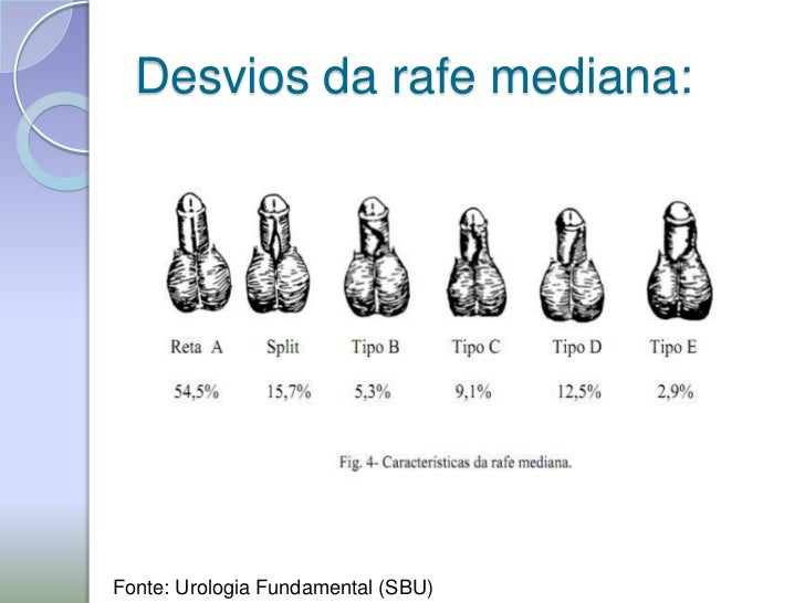 Variações anatômicas e algumas patologias do Sistema Genital Masculino