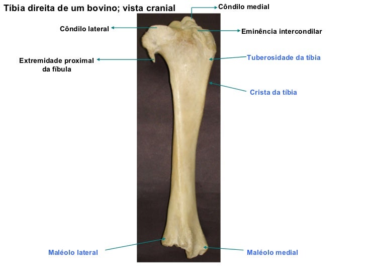 Apresentação membro pélvico.