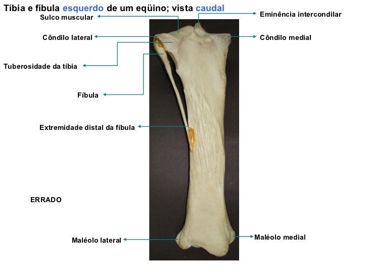 Radiografia Da Fossa Intercondilar