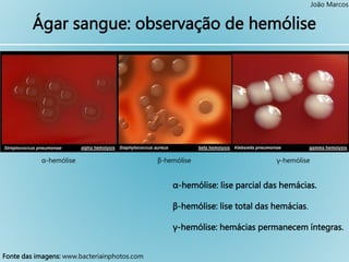 Microbiologia: meios de cultura e provas de identificação | PPT