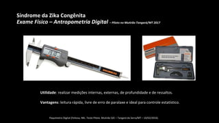 Síndrome da Zika Congênita | PPT