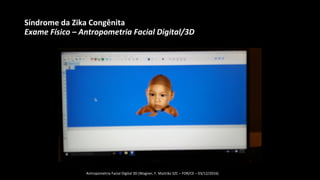 Síndrome da Zika Congênita | PPT