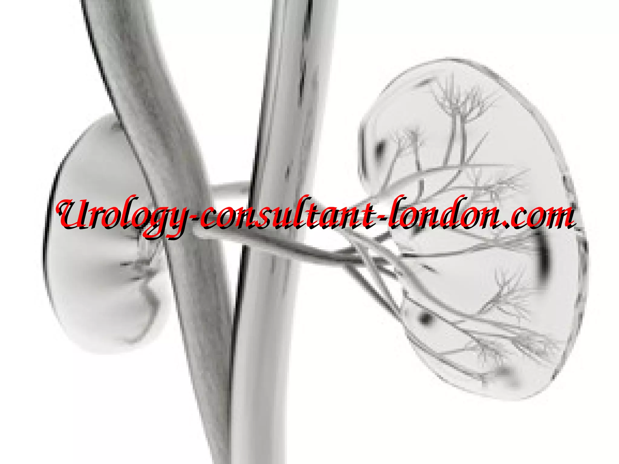 A presentation of urology clinic's location guide in uk | PPT