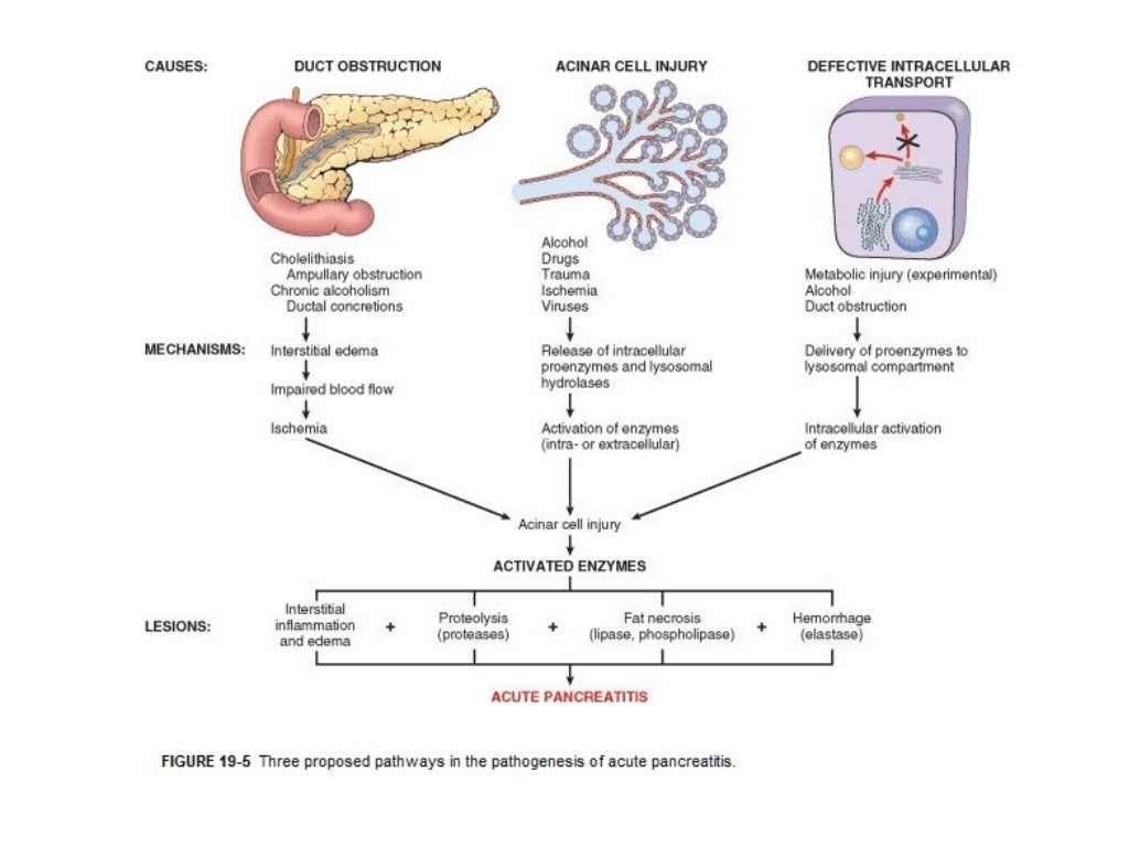 Acute pancreatitis