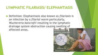 A presentation on Elephantiasis.pptx