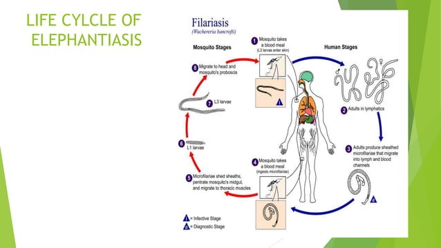 A presentation on Elephantiasis.pptx