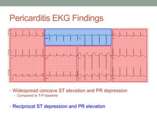 EKG Of The Month April 2017 | PPT