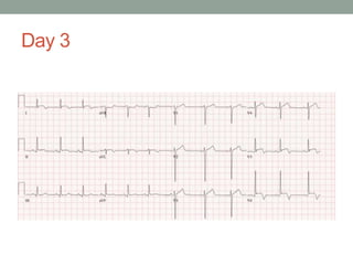 EKG Of The Month April 2017 | PPT