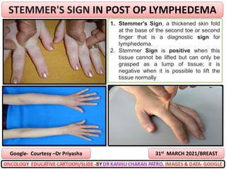 APRIL 2021 ONCOLOGY CARTOONS | PDF | Cancer | Diseases and Conditions