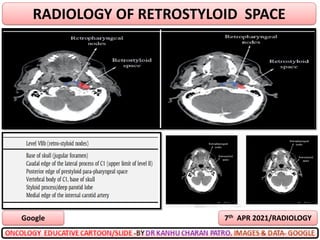 APRIL 2021 ONCOLOGY CARTOONS | PDF | Cancer | Diseases and Conditions