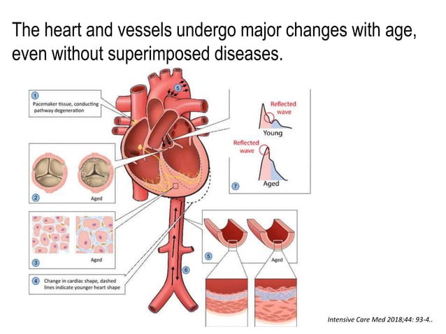 Geriatric Cardio-Oncology | PPTX