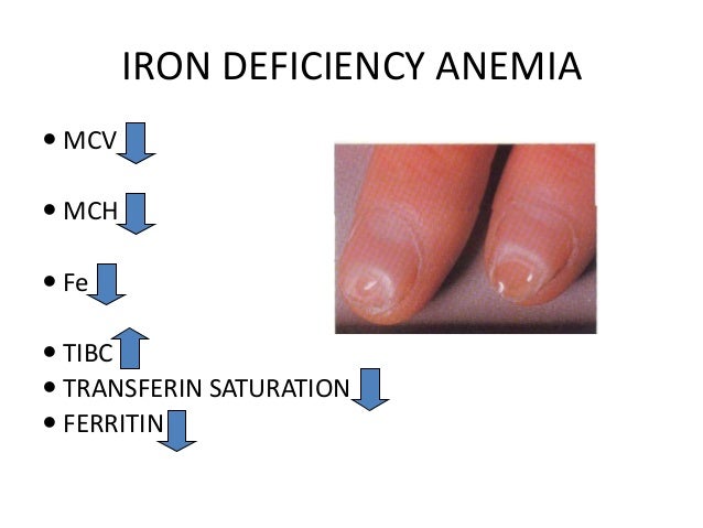 Aproach to anemia