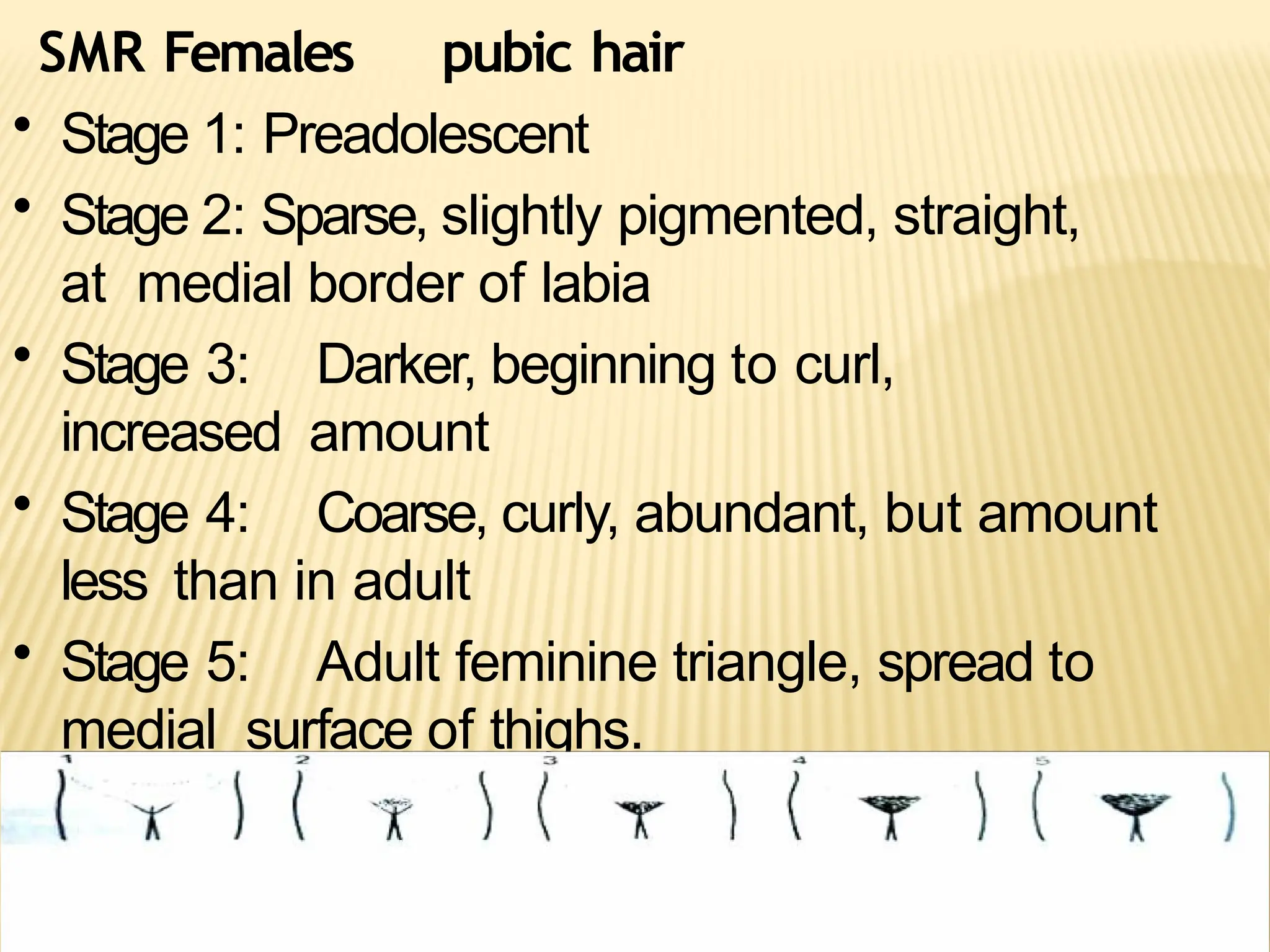 An aproach to a short stature patient ppt | PPTX