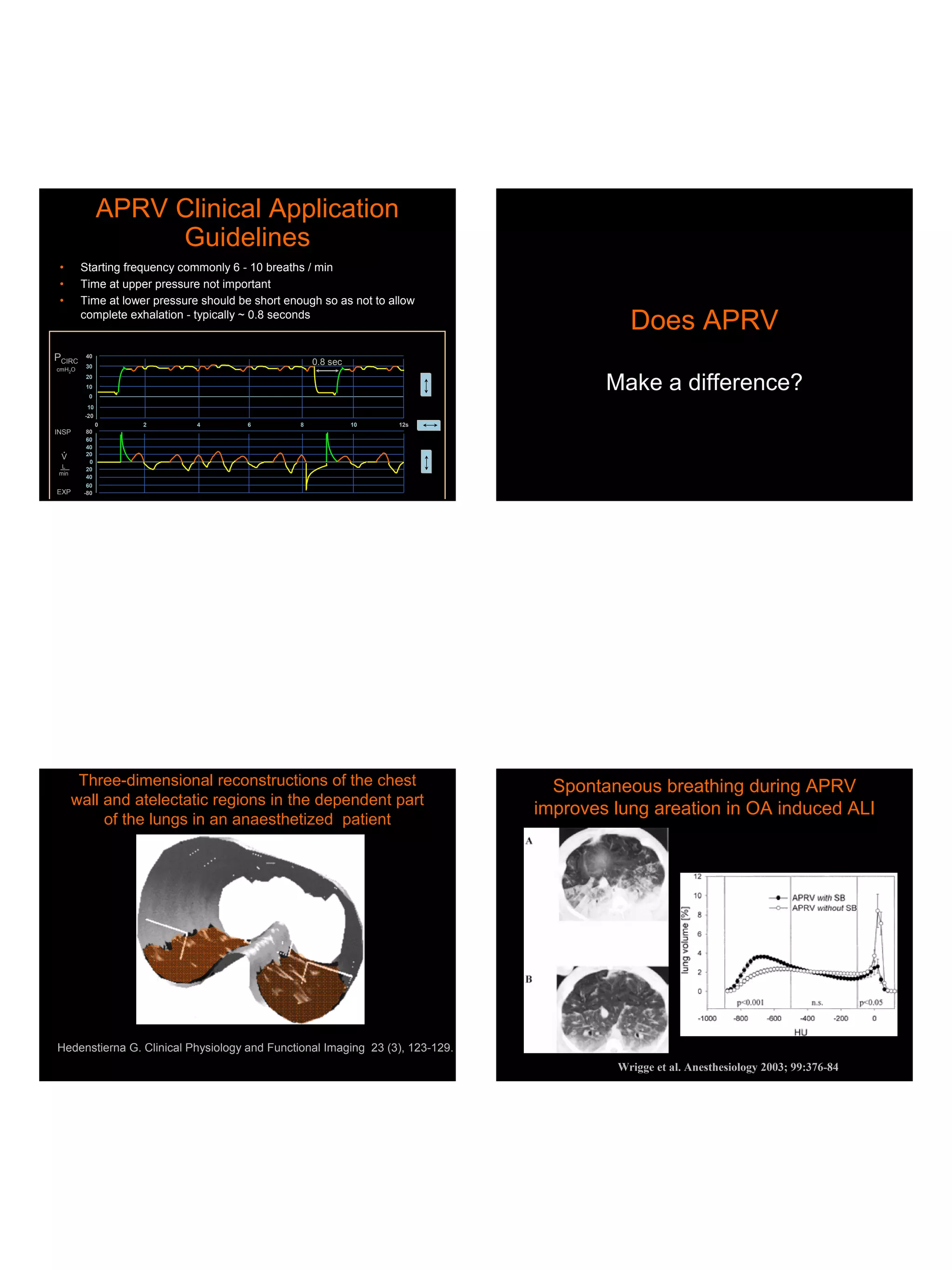 APRV aka BiLevel | PDF | Lung and Respiratory Health | Diseases and ...