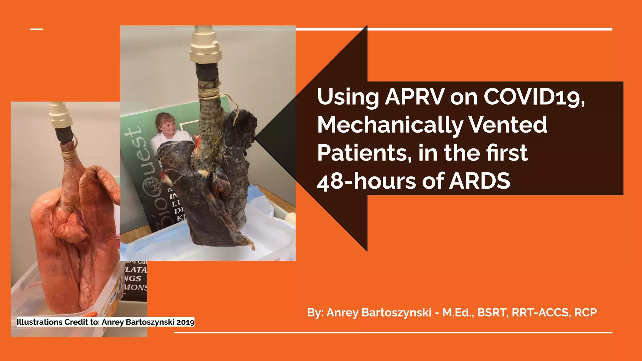 APRV on COVID19 ARDS Presentation.pdf