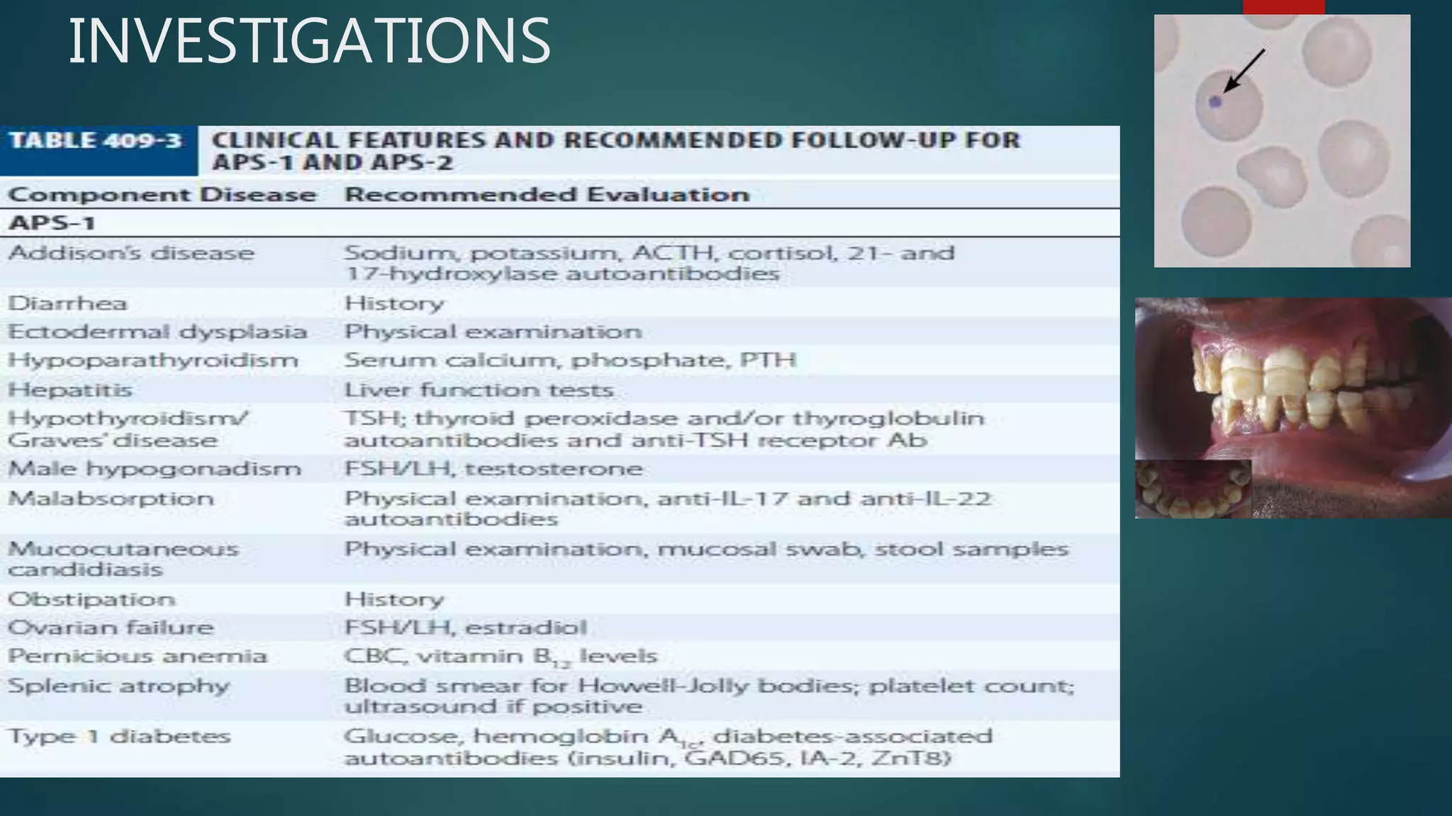 Autoimmune polyendocrine syndromes (APS)pptx | PPTX