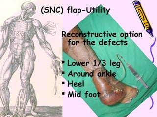 Sural Neurocutaneous Flap by Dr Sumita Shankar, Amaze MedSpa | PPT