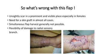 relevance of RAFF in present day head and neck reconstruction.pptx