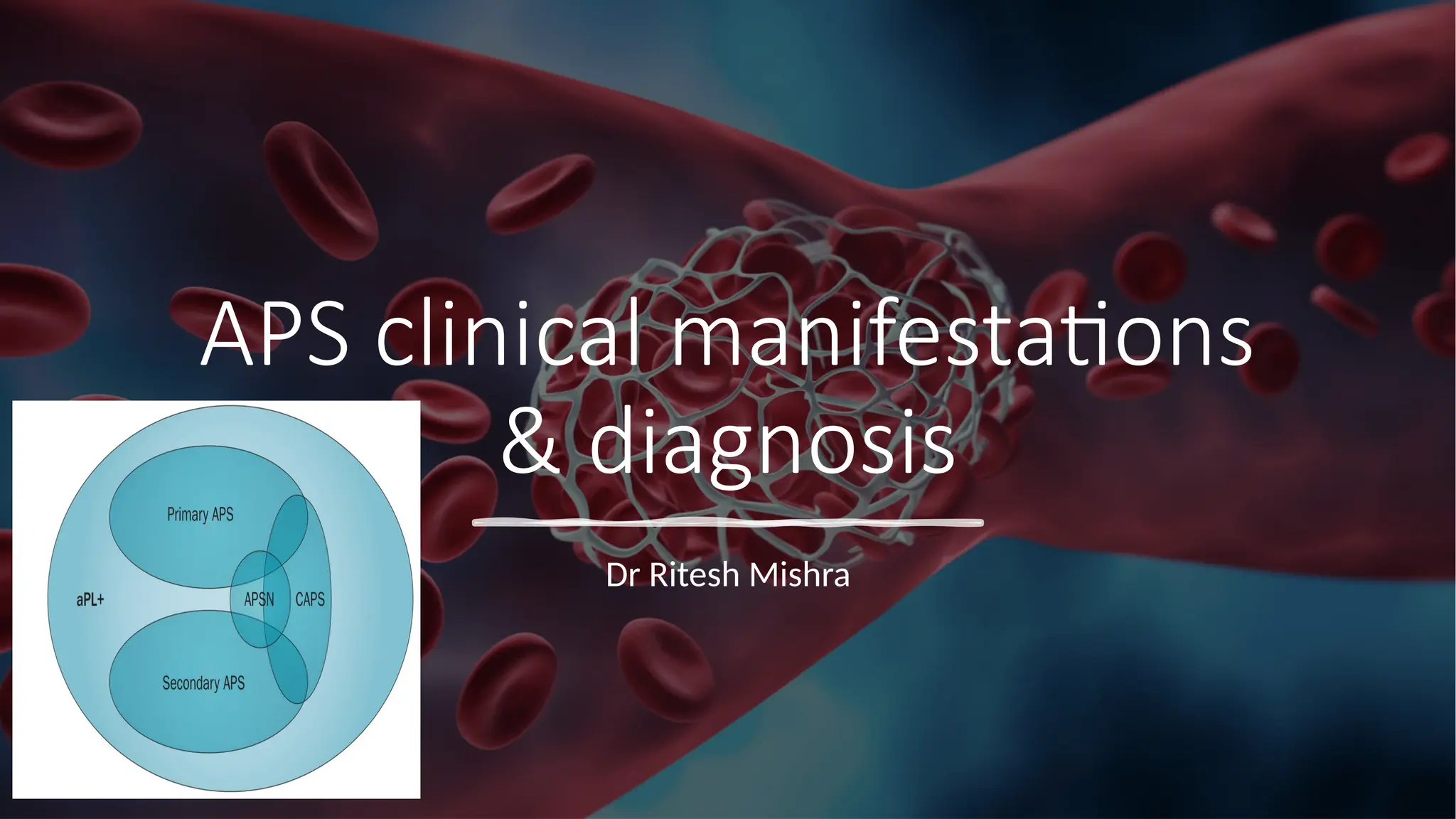 Antiphospholipid syndrome-clinical manifestations and criteria | PPTX