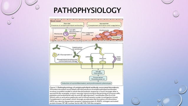 Antiphospholipid syndrome - diagnosis RX | PPT | Free Download