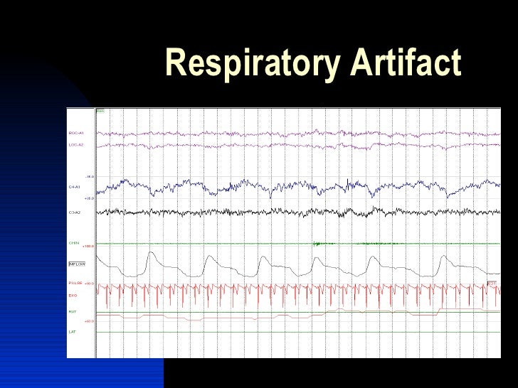 Apt artifact recognition & troubleshooting