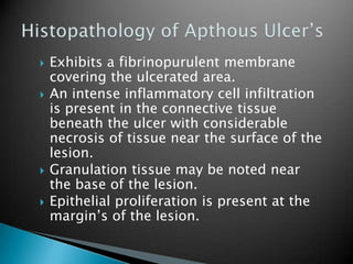 Management and Treatment of Recurrent Apthous ulcer’s | PPTX