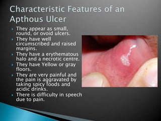 Management and Treatment of Recurrent Apthous ulcer’s | PPTX